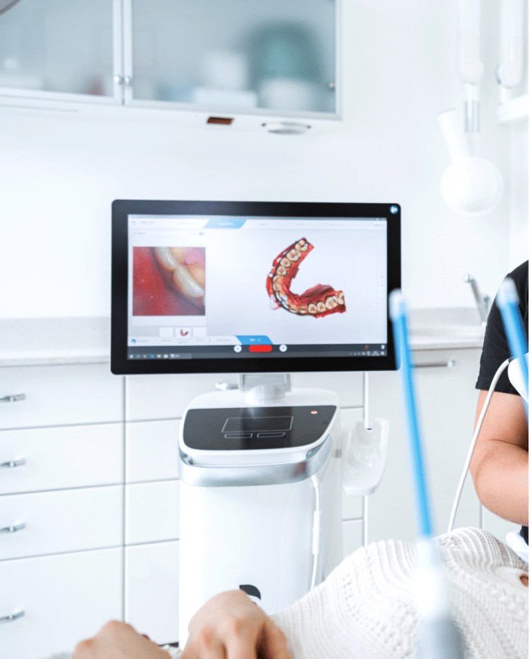 Digital Dental Impressions - The Hills Family Dentistry - Intraoral ...