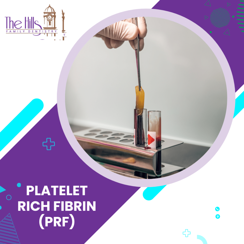 Platelet-Rich Fibrin (PRF) in Oral Surgery Procedures - The Hills ...